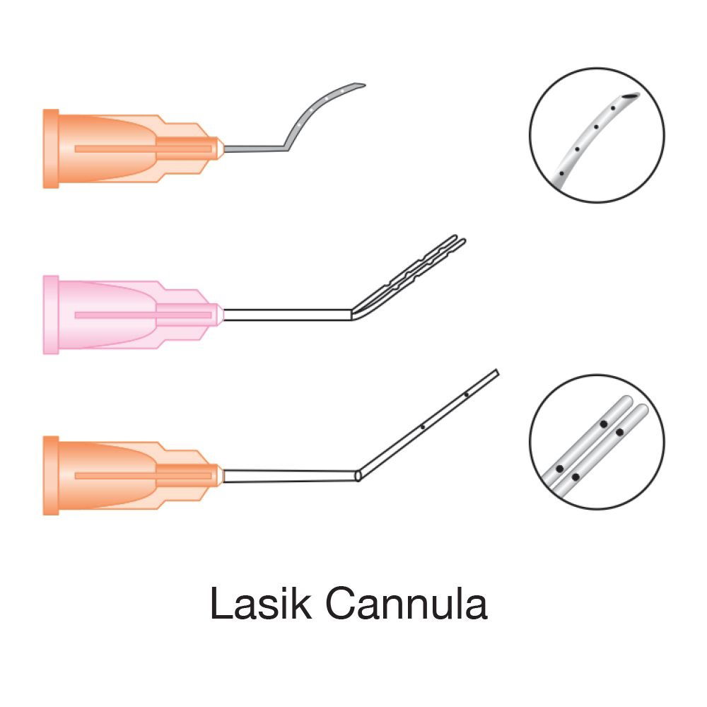 Lasik Cannula - Madhu Instruments Pvt. Ltd. | Medzell