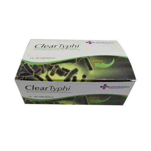 S.Typhi IgG/IgM Card 40T - Typhoid Test Kit - Recombigen Laboratories ...