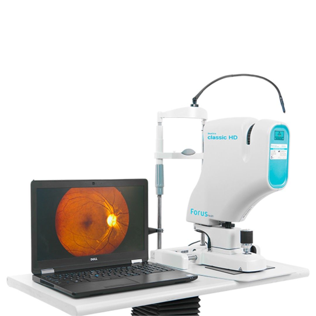 3nethra classic HD - Digital Fundus Camera | Forus Health Pvt. Ltd.