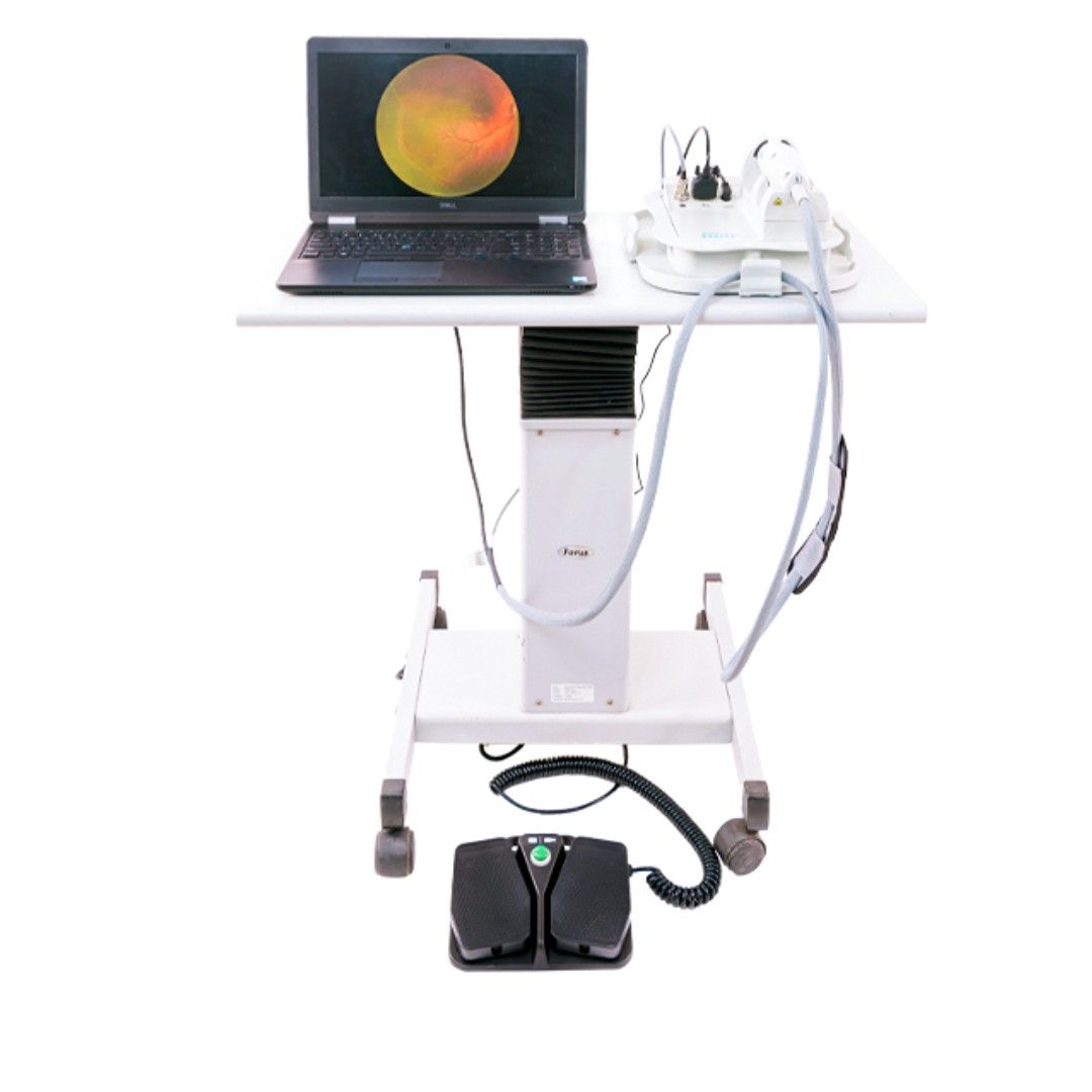 3nethra neo - Advanced Digital Wide-field Imaging Systems | Forus ...