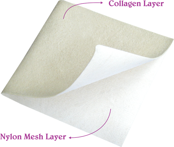 Kollagen®-D: Sterile Porous Collagen Dressing | EUCARE Pharmaceuticals