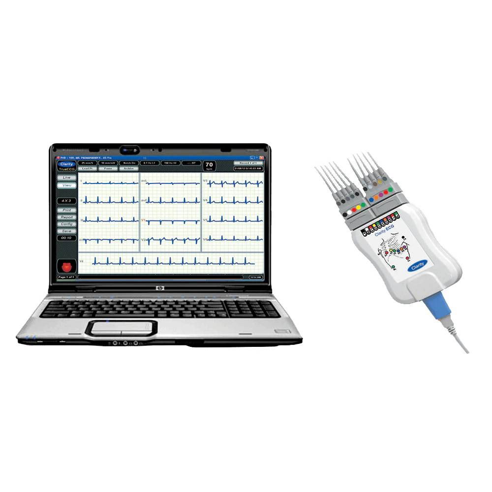 Buy Clarity ECG Machine Online - Affordable & High-Quality