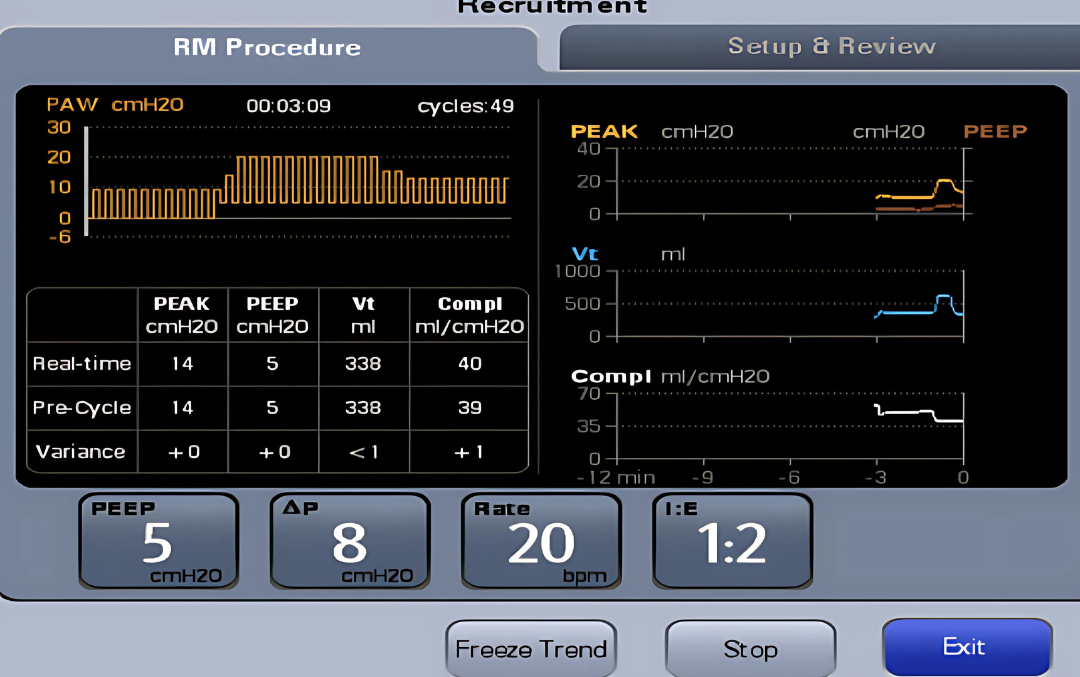A5 Anesthesia Machine - anesthesia workstation with inbuilt ventilator ...