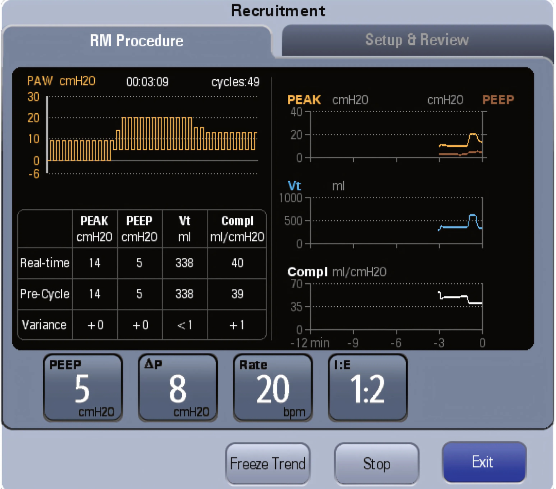 A7 Anesthesia System - anesthesia workstation with inbuilt ventilator ...