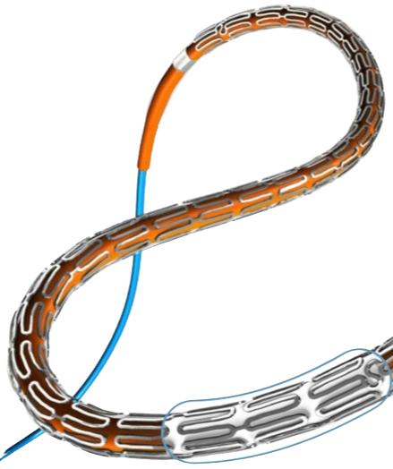 ADVA PRO Sirolimus Stent System | Advanced MedTech Solutions