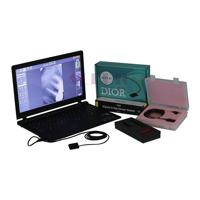 Digital intra oral sensor(ALERIO DIOR) - Iatome Electric (I) Pvt. Ltd ... Digital intra oral sensor(ALERIO DIOR) - Iatome Electric (I) Pvt. Ltd ...