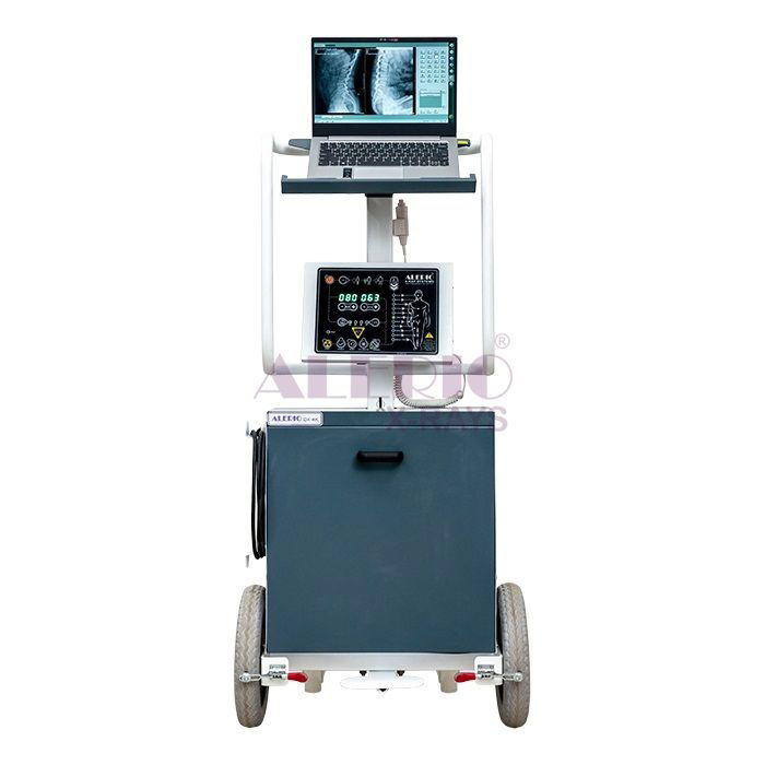 Digital Mobile X-Ray ALERIO Smart 4000 DX - Iatome Electric (I) Pvt ...