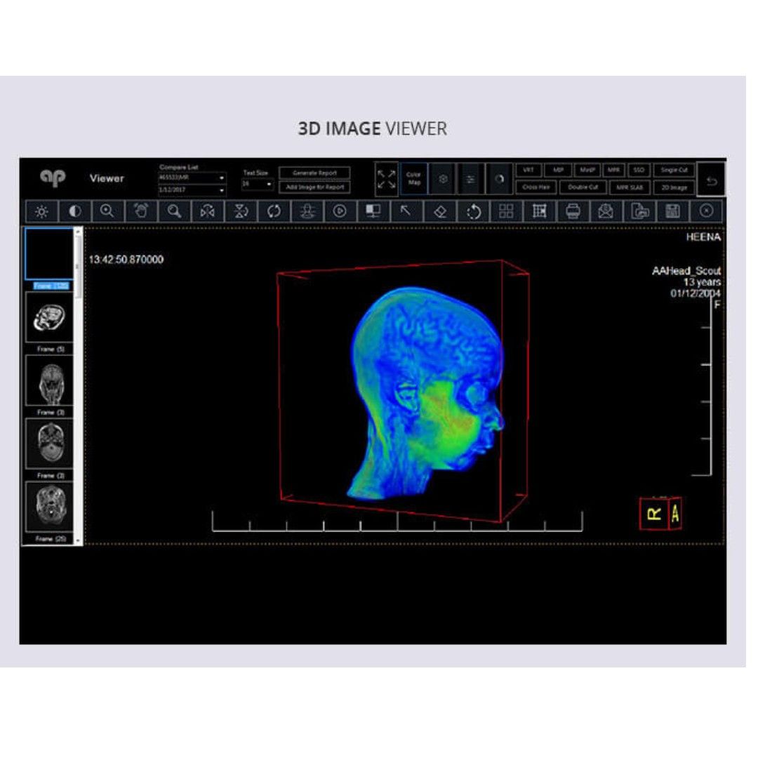 Allengers PACS - Leading PACS System Provider from India