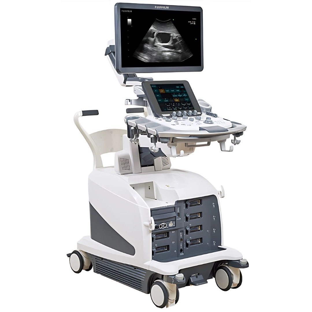 ARIETTA 750 - Portable 3D ultrasound system | FUJIFILM Sonosite Inc.