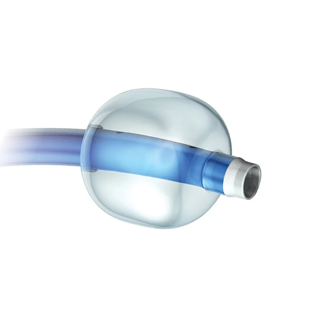 FlowGate² Balloon Guide Catheter | Stryker Neurovascular
