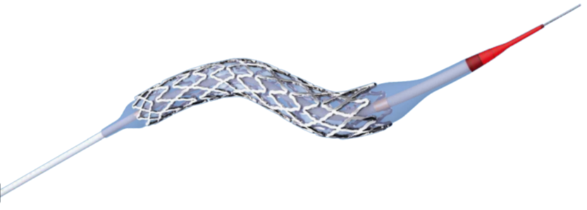 Koronar Sirolimus Eluting Stent System - Newtech Medical Devices