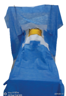 Surgeons Micro Barrier India: General Surgery Drapes OT-3018 CABG Drape