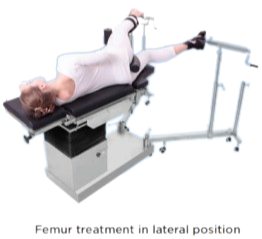 TMI-1206 ALBEE'S TYPE (Ortho Attachment) - Operating Tables - Koinamed ...