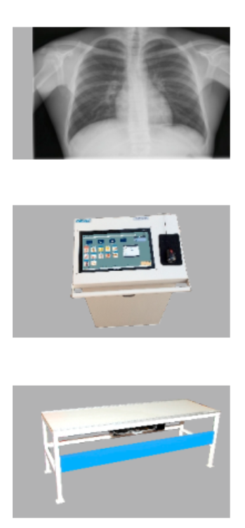 Classic - 100 F Fixed X-ray Radiography System - Orvee Medical ...