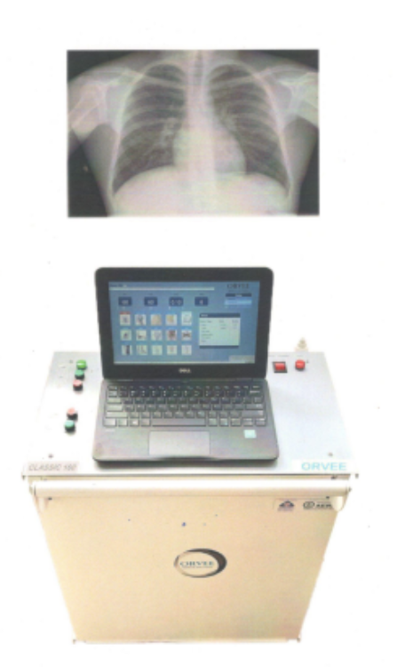 Classic - 160 X-Ray Radiography System - Orvee Medical Solutions ...