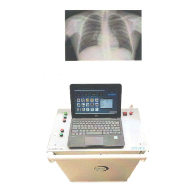 Classic - 300 X-Ray Radiography System - Orvee Medical Solutions ...