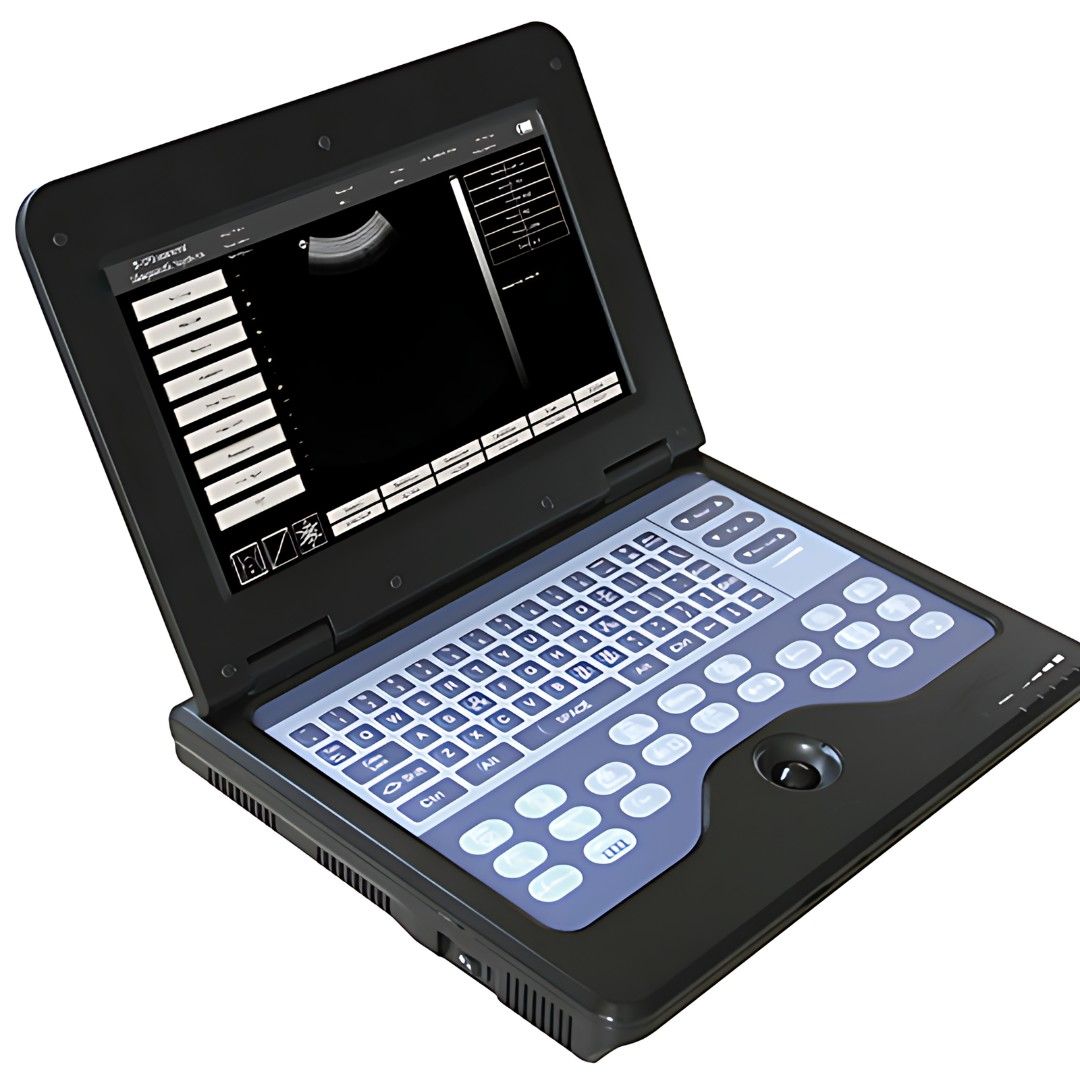 Contec CMS600P2 - B-Ultrasound Diagnostic System | Contec Medical Systems