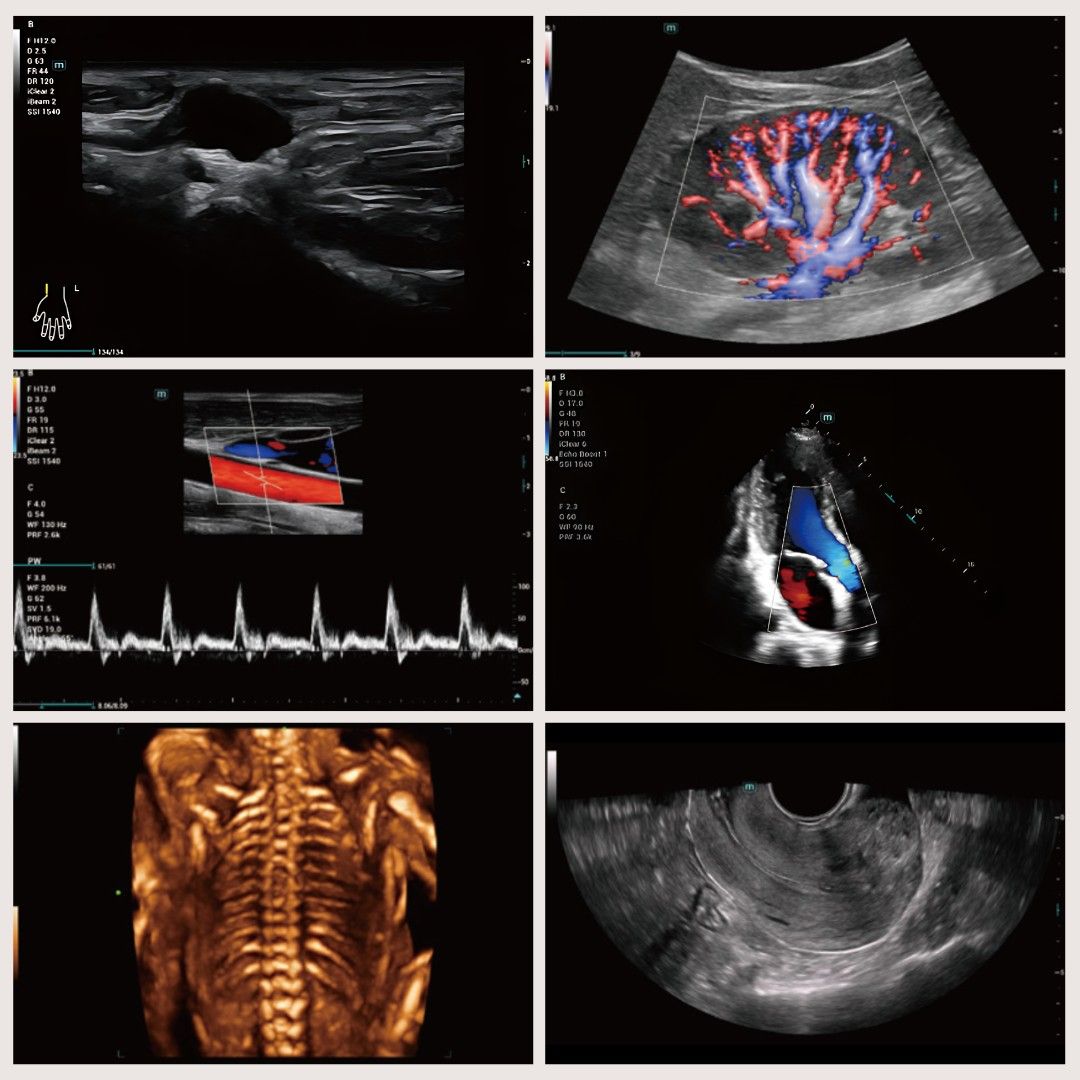 Consona N7 Ultrasound System | Top Quality Imaging Solutions