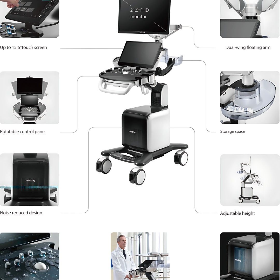 Consona N8 Ultrasound System | Affordable Top Quality Imaging Solutions