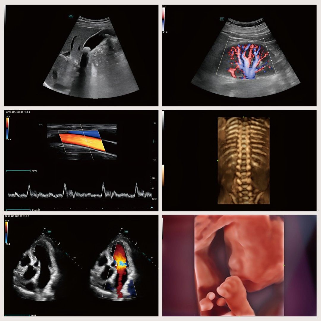 Consona N8 Ultrasound System | Affordable Top Quality Imaging Solutions