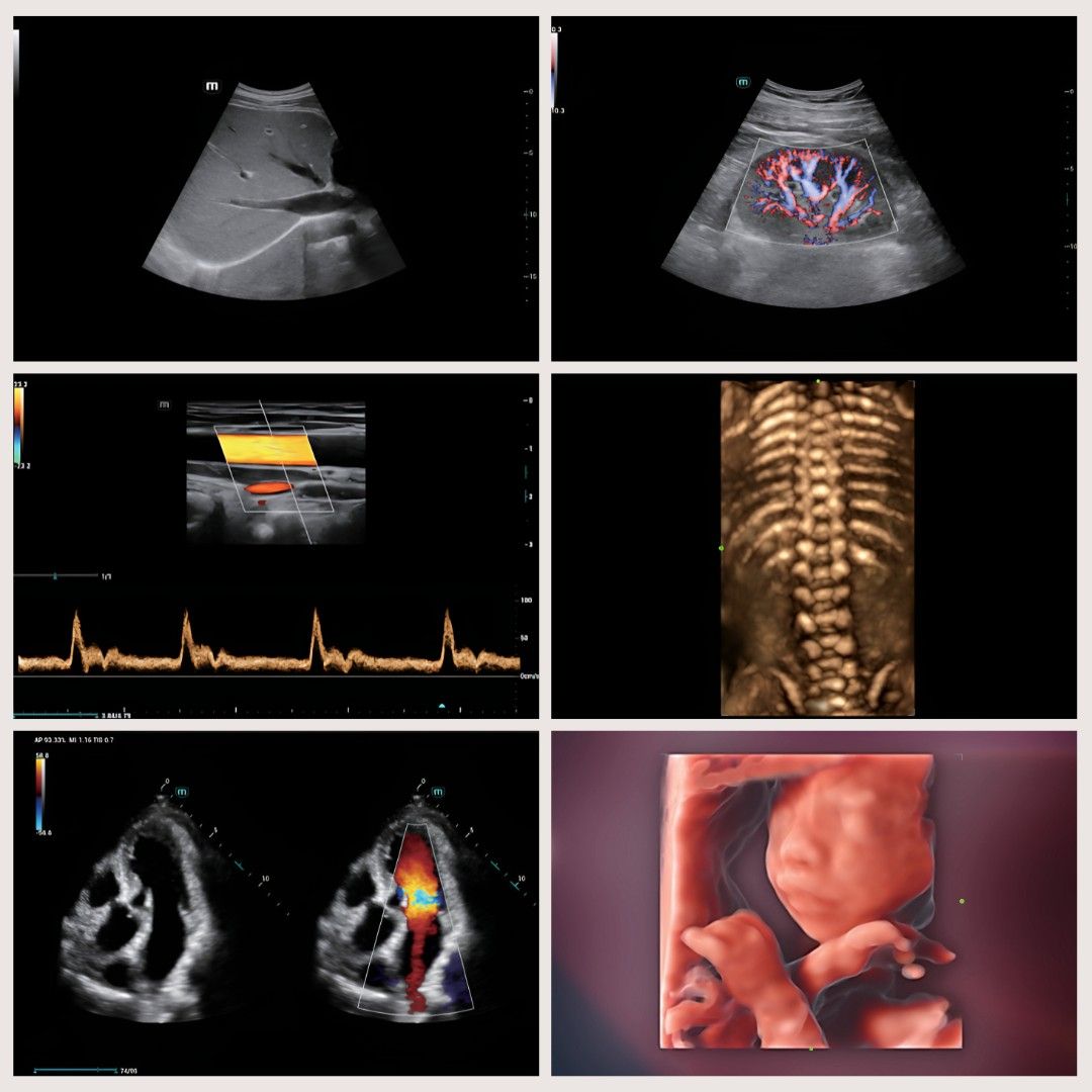 Consona N9 Ultrasound System | Top Quality Imaging Solutions