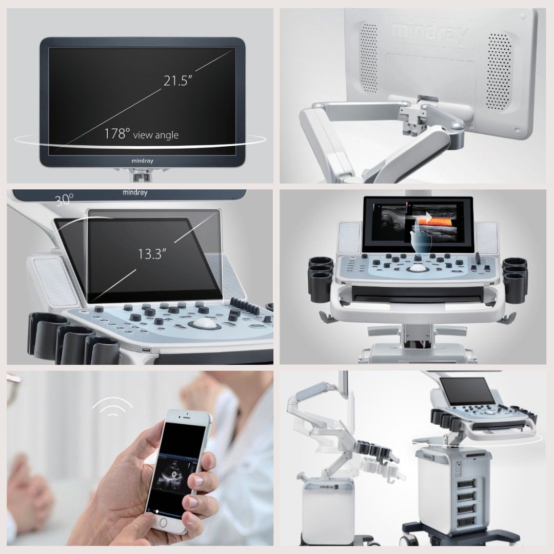 DC-60 ECHO with X-Insight: Advanced Ultrasound System for Sale in South ...