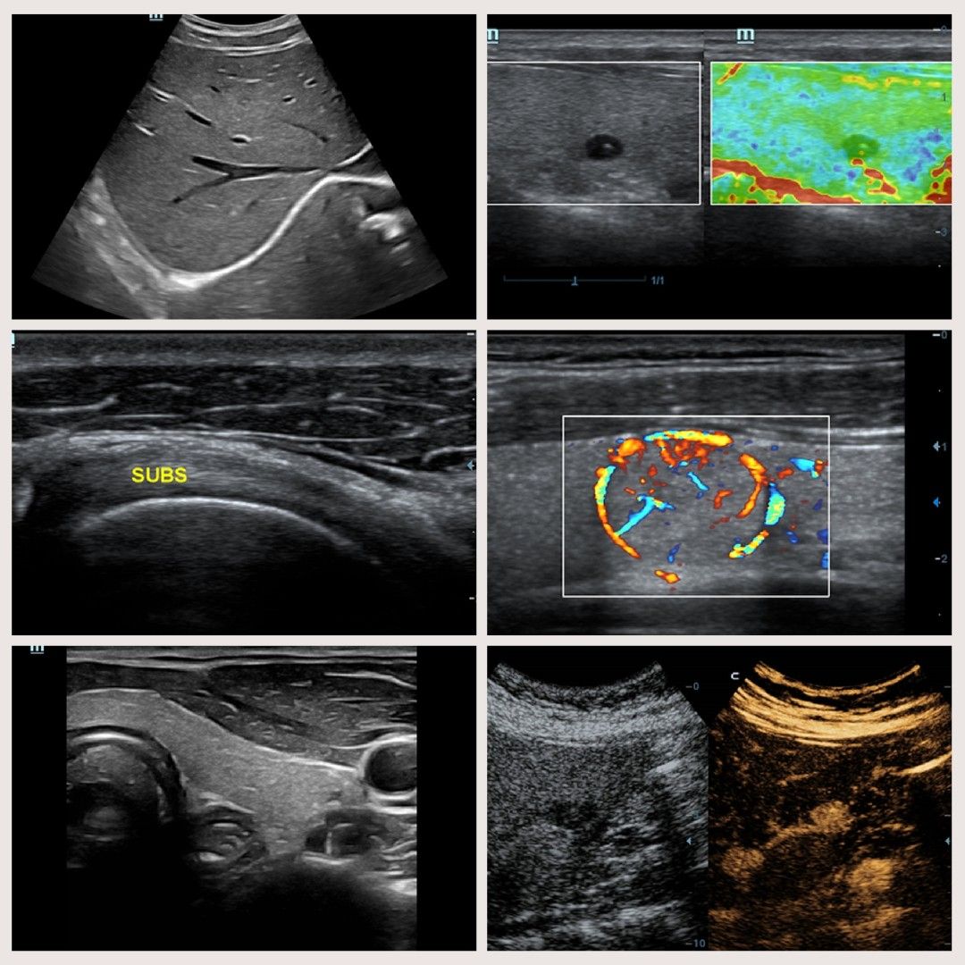 Cutting-Edge Ultrasound System with X-Insight | Mindray DC-60 Exp