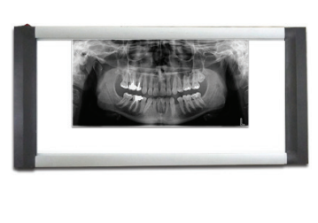 Dental LED X-Ray Viewer by BIO-X India - Medzell
