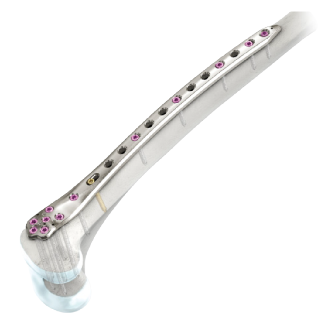 Distal Lateral Femoral Plate 4.5 - aap Implantate AG