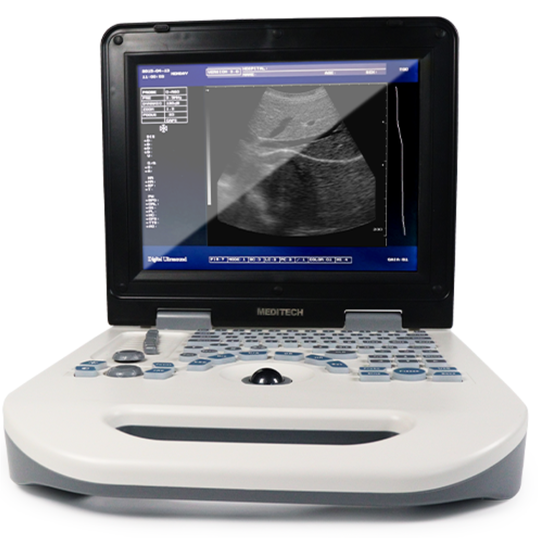 Dolphi® S Ultrasound Scanner - Meditech Equipment Co.