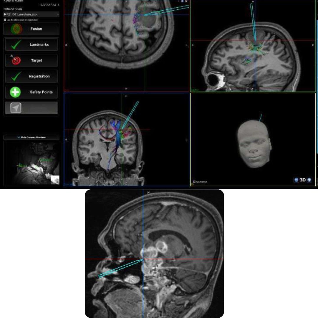 easyNav 2.0 Cranial Surgery Navigation Systems - HRS Navigation