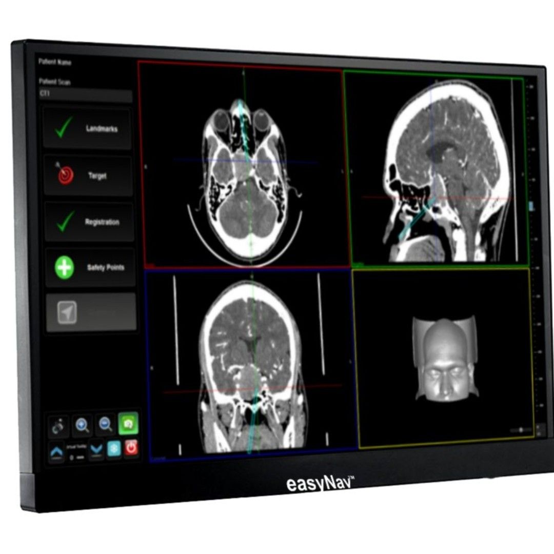 easyNav 2.0 ENT Surgical Navigation System | HRS Navigation
