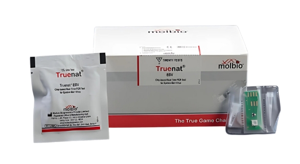 Truenat® EBV Epstein-Barr Virus Test Kits by Molbio