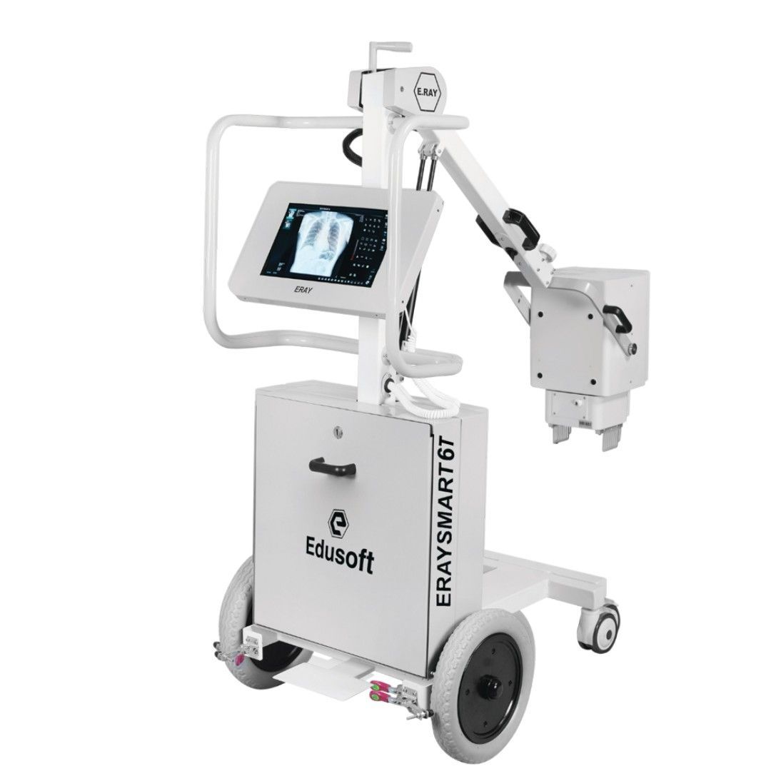 ERAY SMART 6i Integrated Digital Mobile/Portable X-Ray | Edusoft Healthcare
