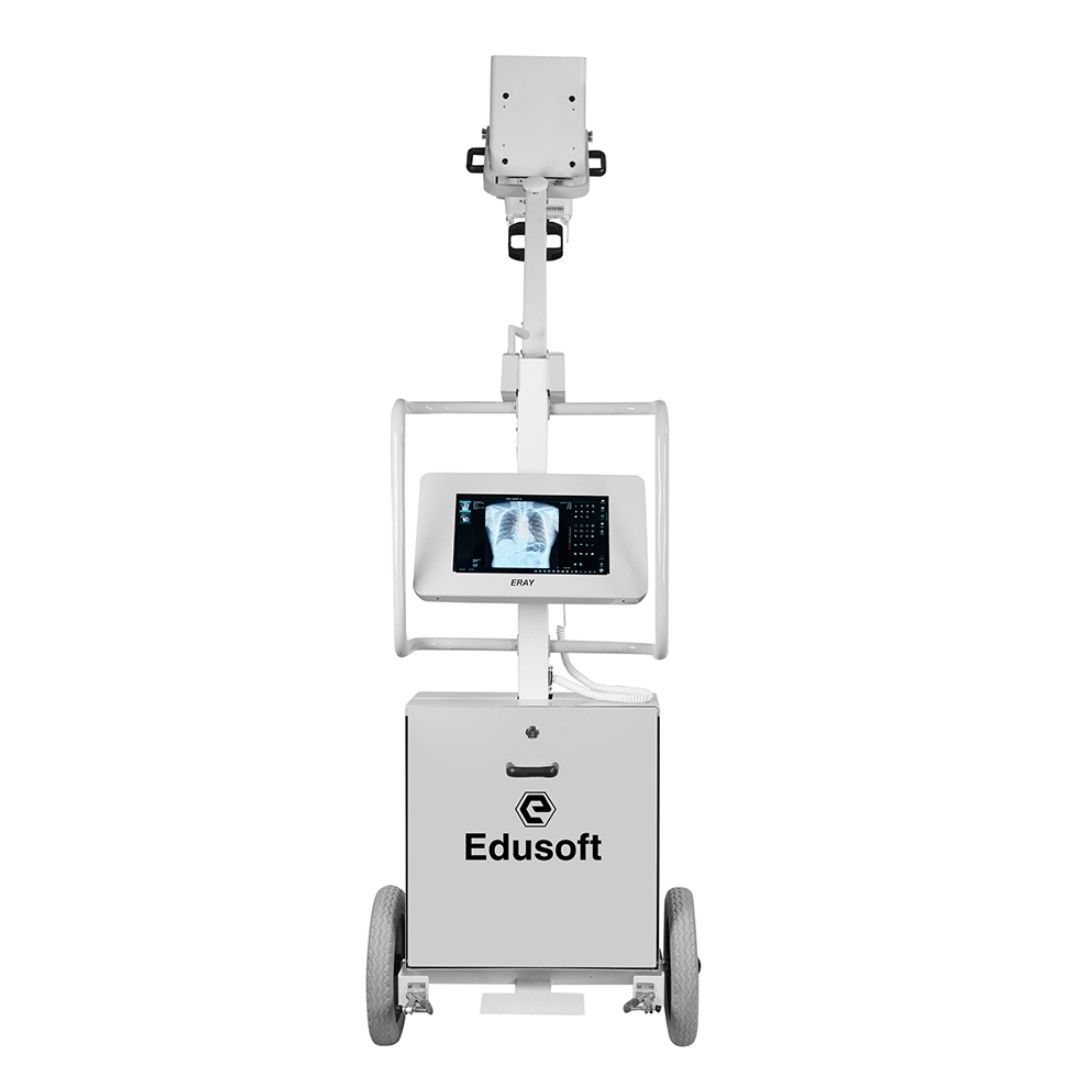 ERAY SMART 6i Integrated Digital Mobile/Portable X-Ray | Edusoft Healthcare