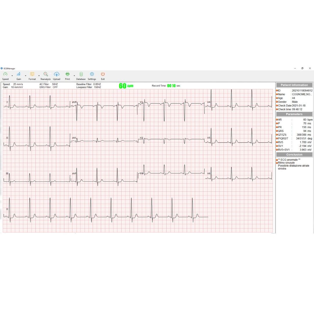 EUROECG Electrocardiographs by LUMED srl | Buy Now