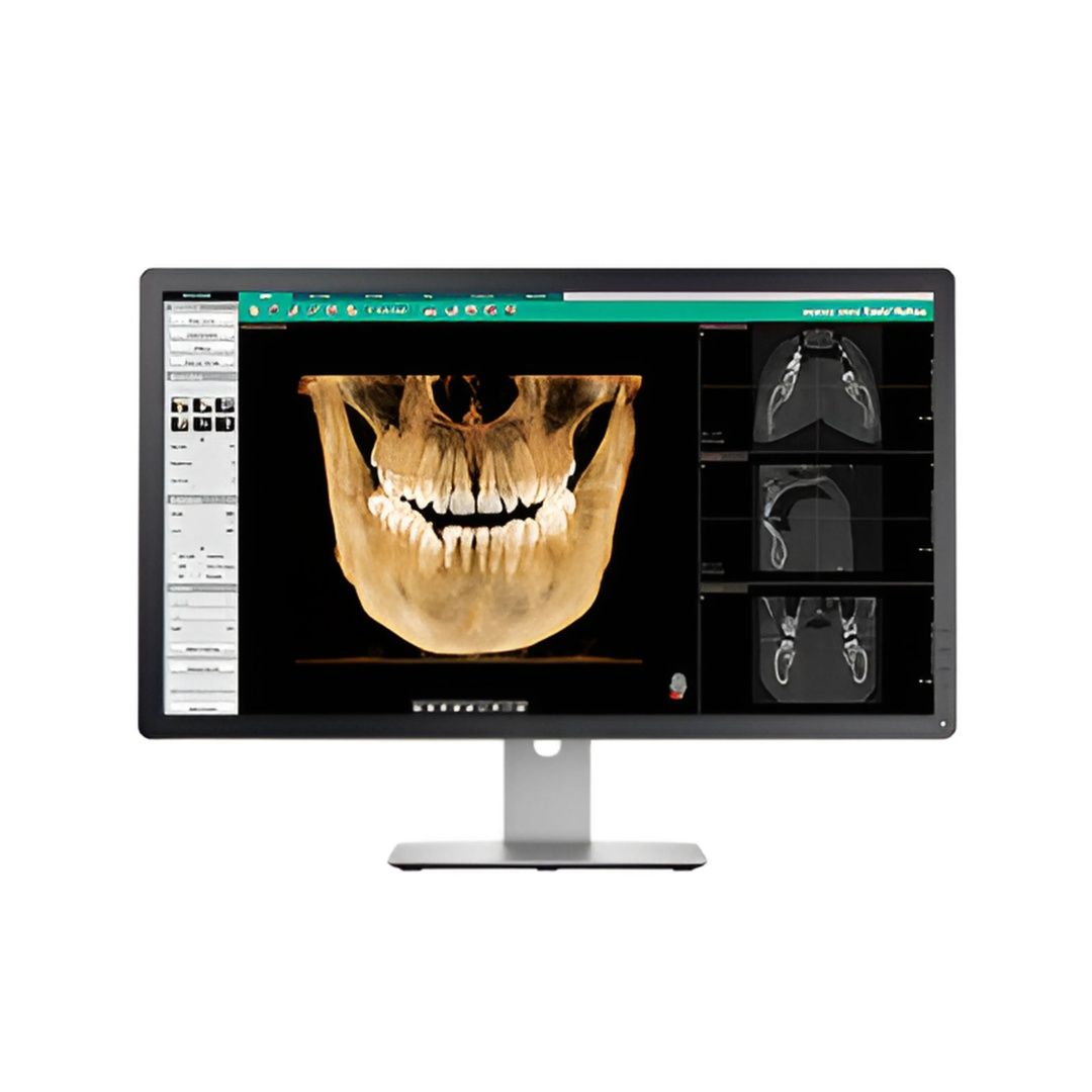 Advanced 3D Dental Software - Ez3D-i™ by Vatech