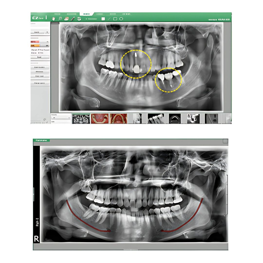 EzDent-i™ 2D Dental Software by Vatech