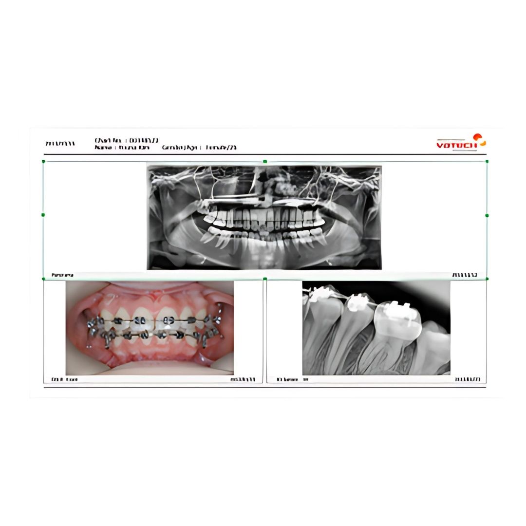 EzDent-i™ 2D Dental Software by Vatech