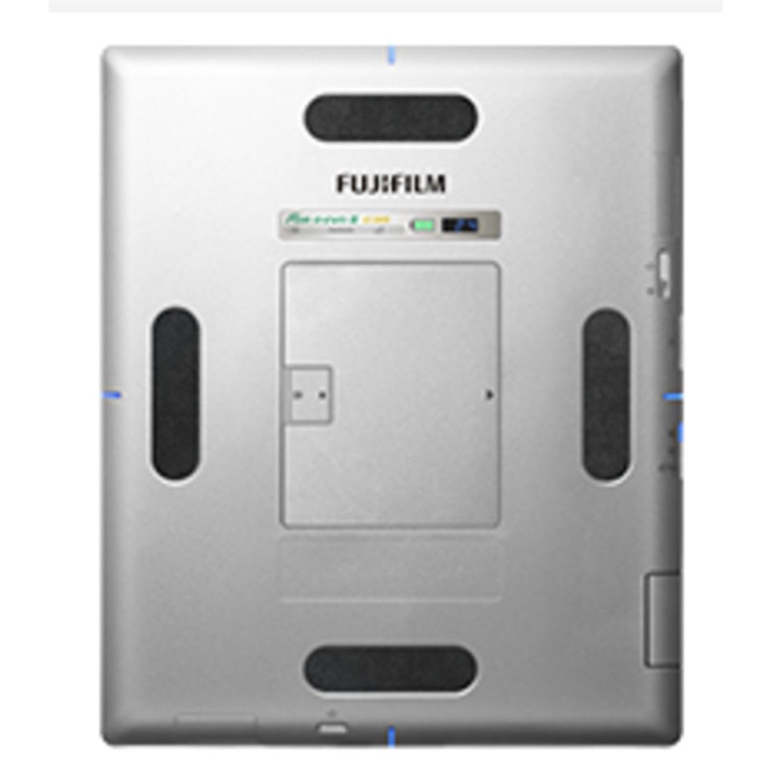 FDR D-EVO II - indirect flat panel detector system | FUJIFILM Sonosite Inc.