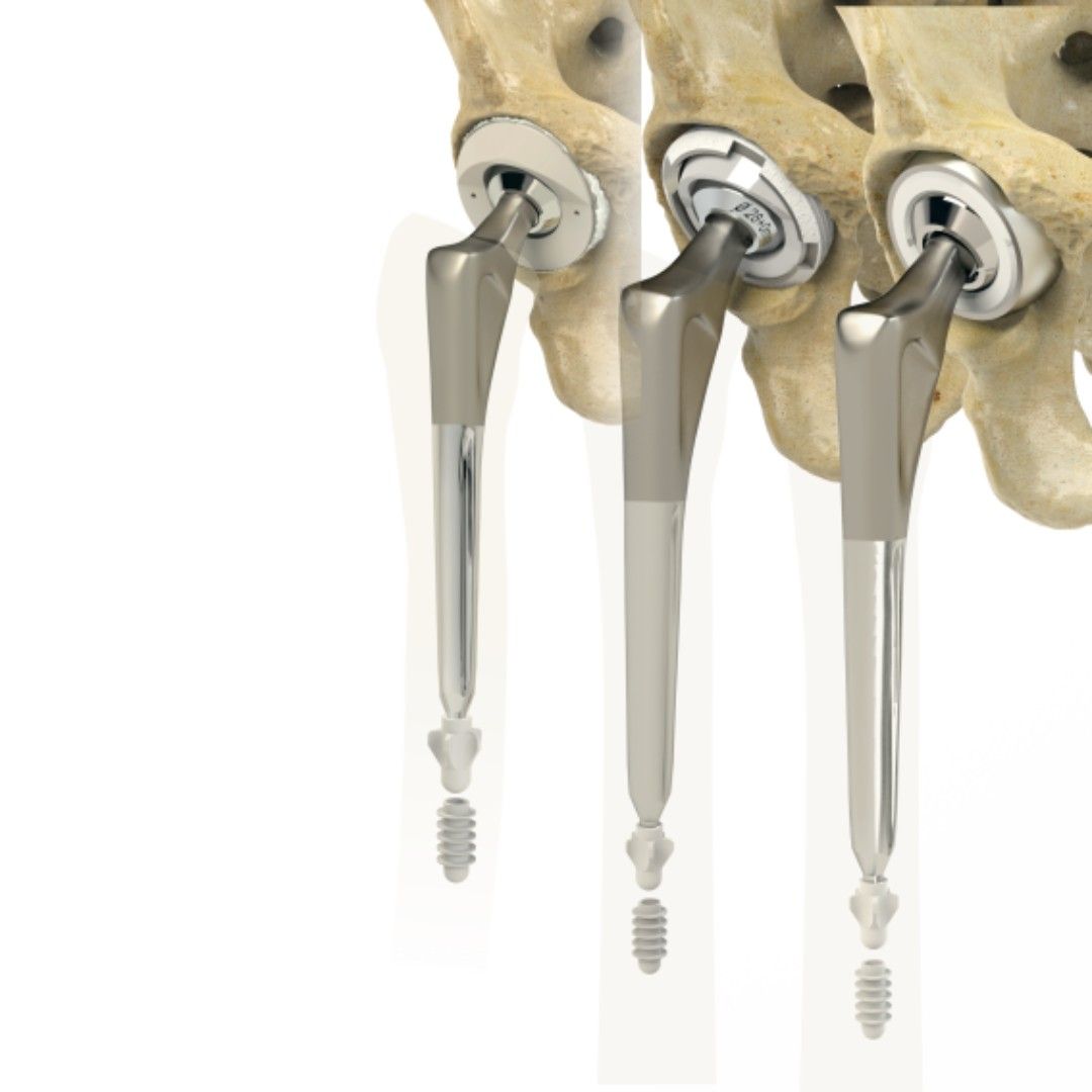 Hip Replacement Implants - All Medical Devices Manufacturers | Medzell ...