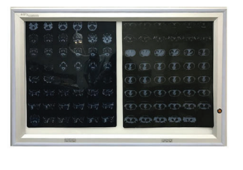 Flush Mounted Led X-Ray Viewer | BIO-X India | Medzell