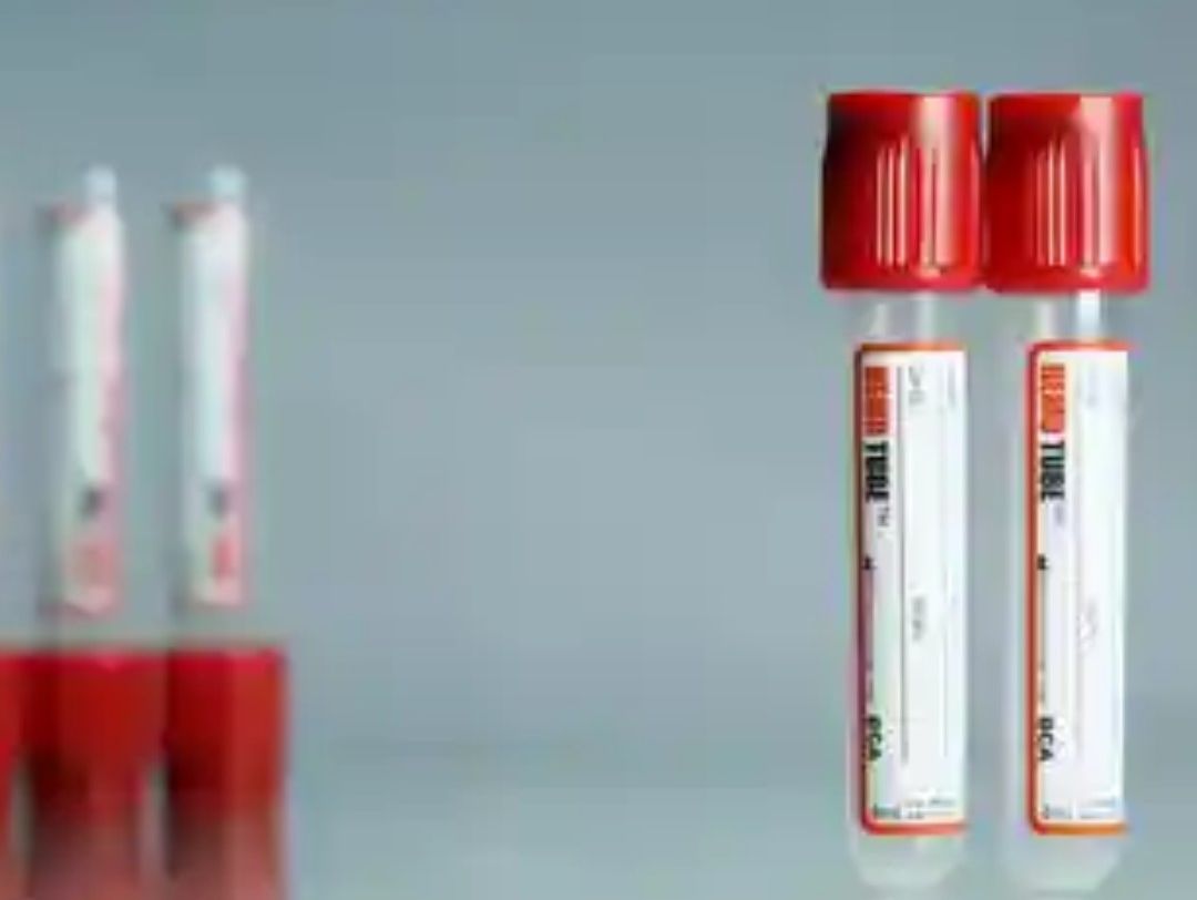 Hemo Tube - Non Vacuum Blood Collection Tubes | MB Plastic Industries