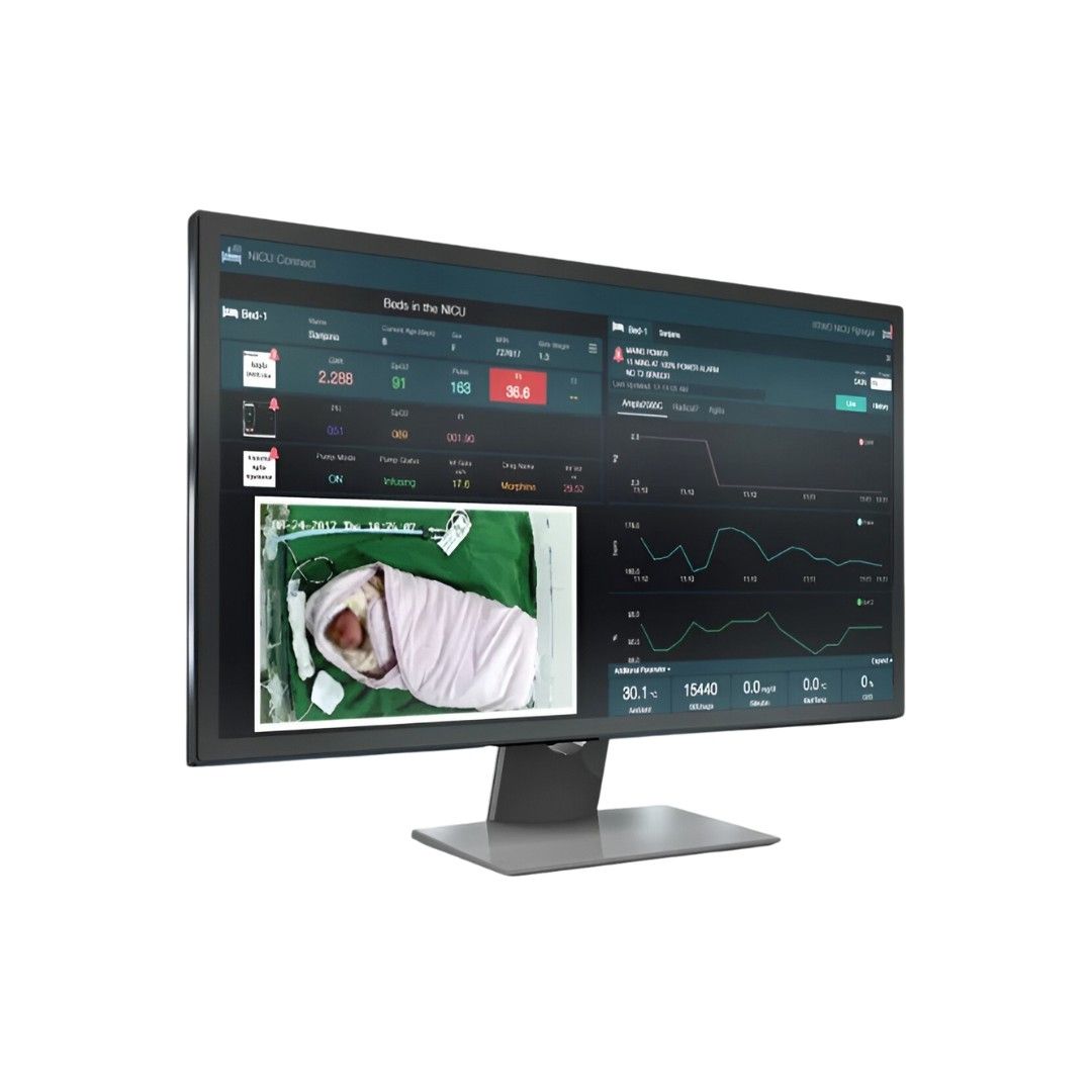 ICU Connect - Rtwo Healthcare solutions