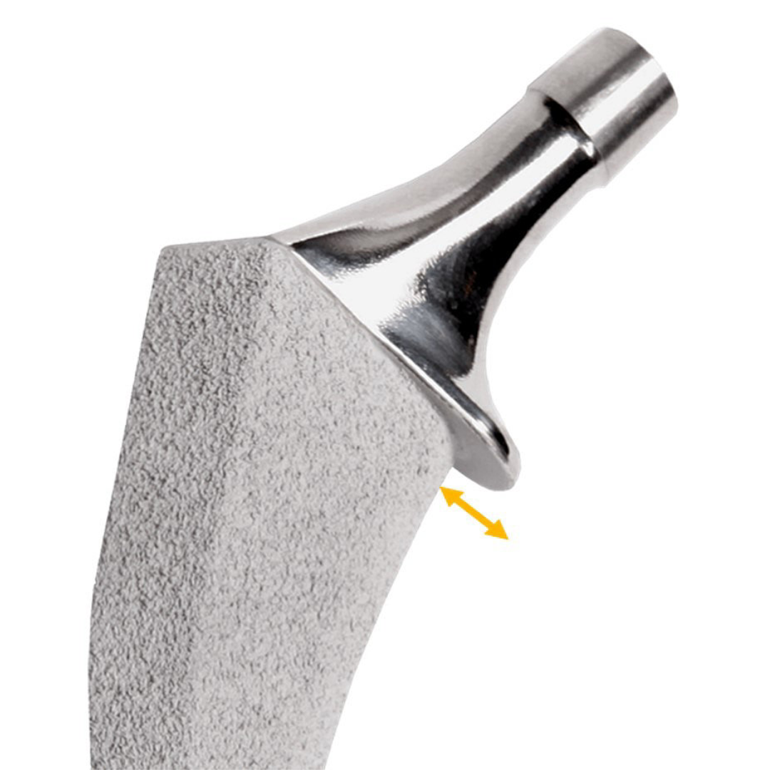 Insignia® Hip Stem - Hip Implant by Stryker