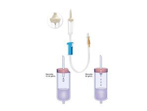 IV Infusion Microdrip Set- DR. AM'S HEALTHCARE | Medzell