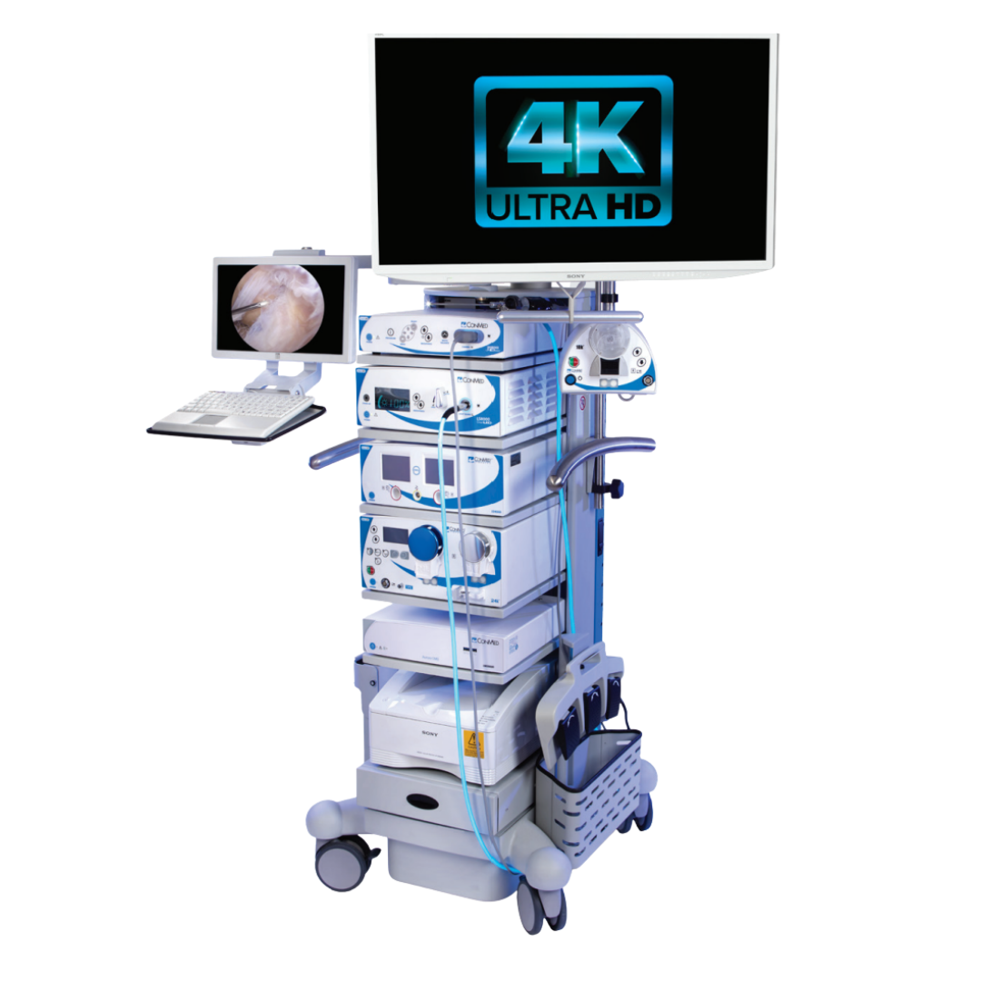 Looking Glass™ 4K Integrated Visualization System | CONMED Corporation
