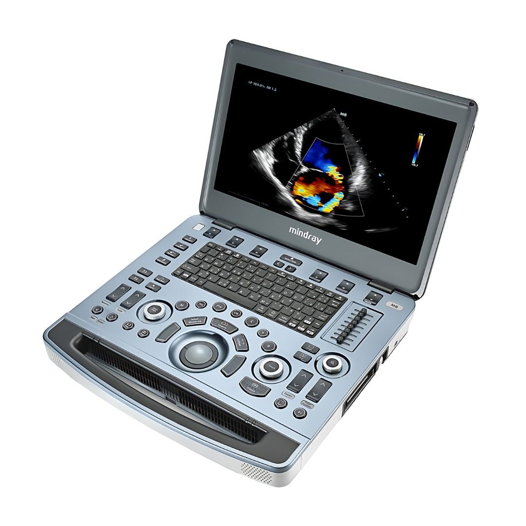 Advanced Portable Ultrasound System - M8 by Mindray Medical ...