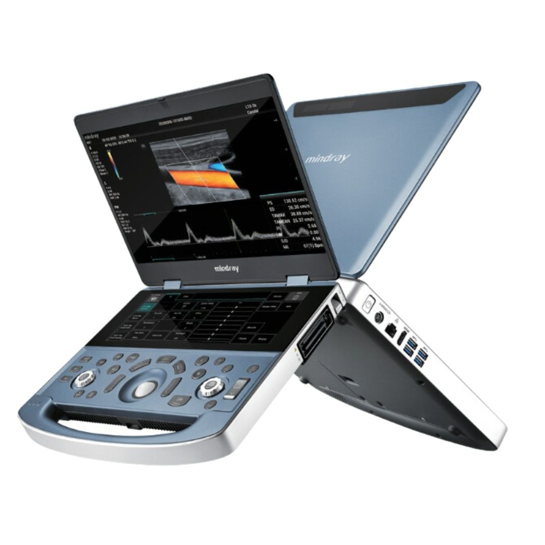 Buy Affordable MX7 Ultrasound System | Mindray Medical International ...