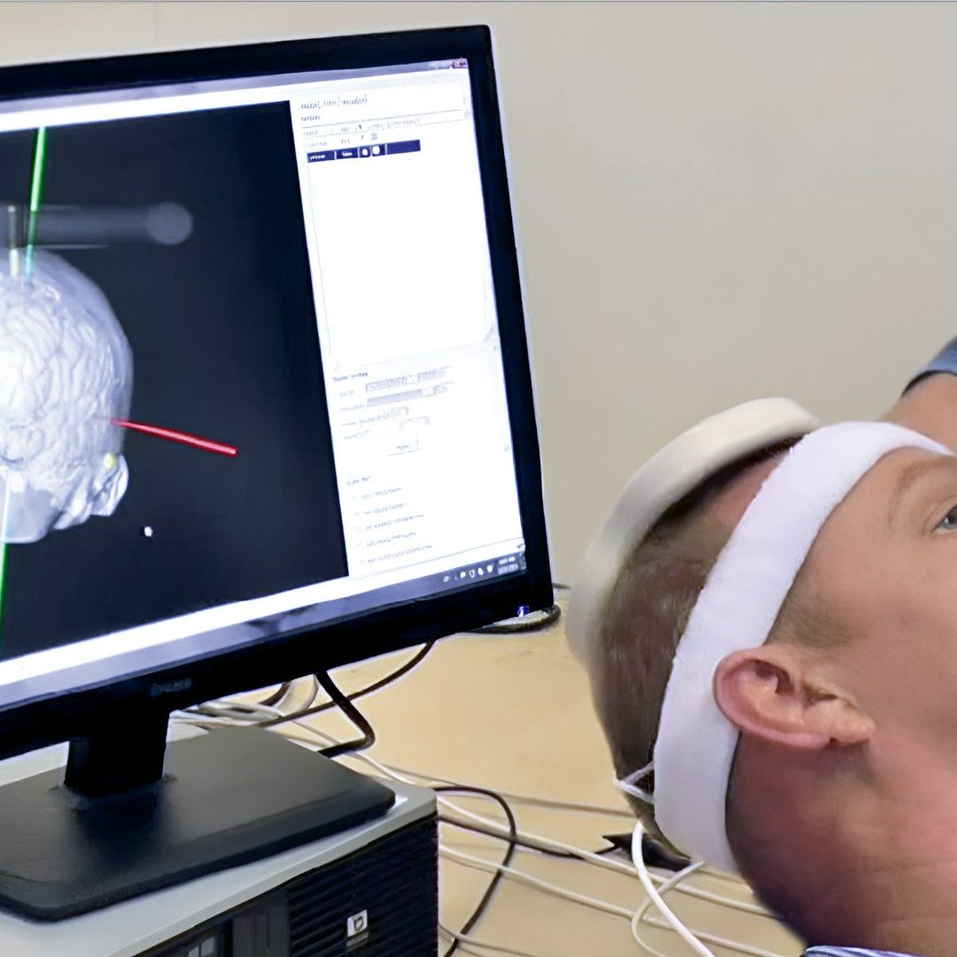 Buy TMS Neuronavigation Systems | Neurosoft | South Africa, Kenya ...